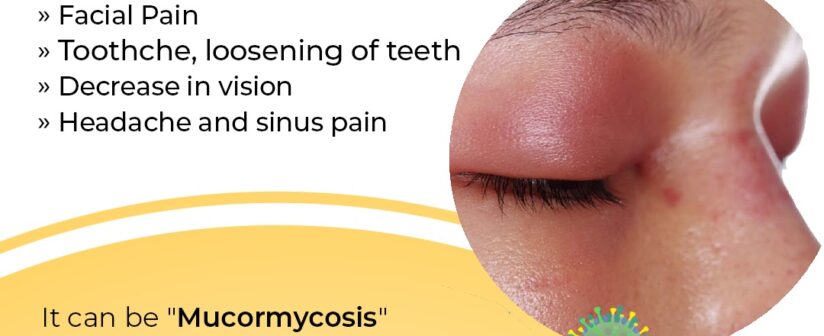 What is Mucormycosis & how it can be treated? | Wavikar Eye Institute