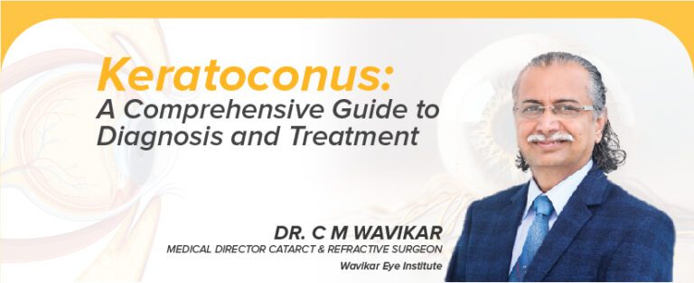 Keratoconus: A Comprehensive Guide to Diagnosis and Treatment - Wavikar Eye Institute
