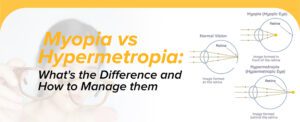 Myopia vs. Hypermetropia: What's the Difference and How to Manage Them?