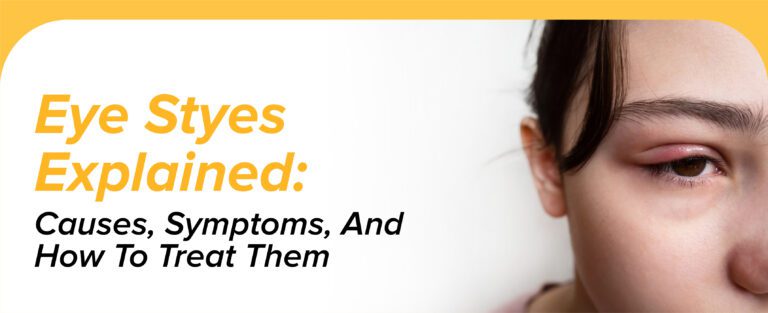 Eye Stye: Causes, Symptoms & Treatment Guide | Wavikar Eye Institute