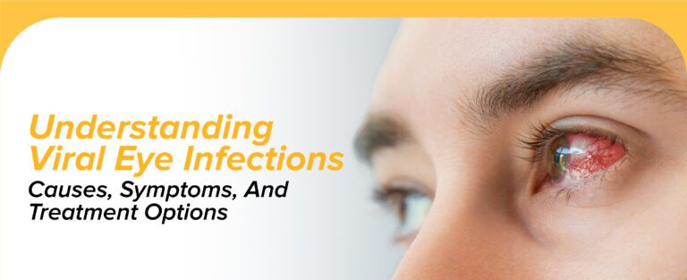 Understanding Viral Eye Infections: Causes, Symptoms, and Treatment ...